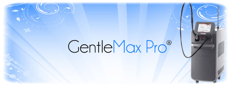 GentleMax Pro – Bella Aesthetica Med Spa